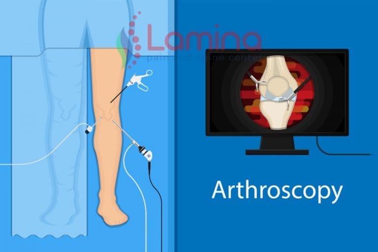 Artroskopi Lutut Adalah Salah Satu Penanganan pada Lutut » Klinik Nyeri ...